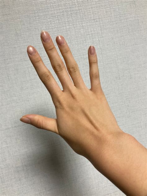 손에 힘을주면 엄지손가락이 이상하게 꺾이고 아파요 지식in