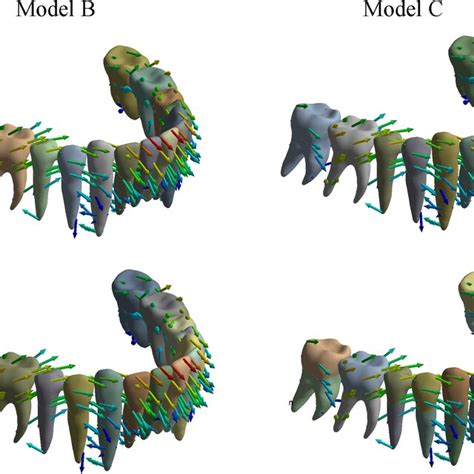 The Movement Tendency Of The Mandibular Dentition In Models With Class Download Scientific