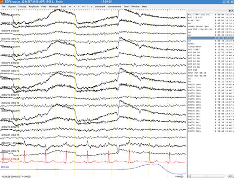 eeg free eeg software download