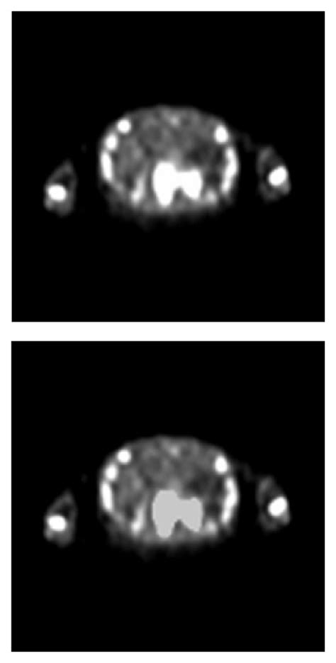 A And B Show Two Examples Of Acceptable Segmentation Results And