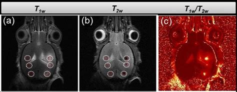 32 Ex Vivo Contrast Effect Of Fe Ncp The Ex Vivo Fe Ncp A T 1w And