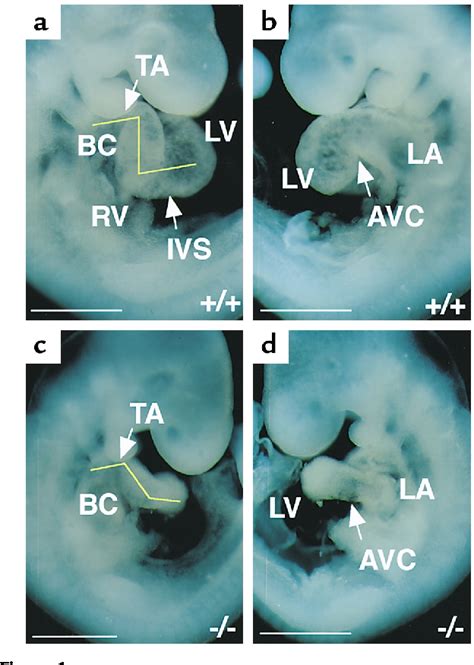Figure 1 From The Polycomb Group Gene Rae28 Sustains Nkx25csx Expression And Is Essential For