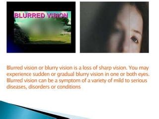 Blurred Vision Pptx