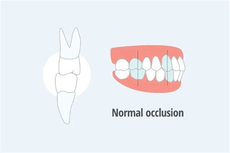 Occlusion Importance Types And Treatment Options