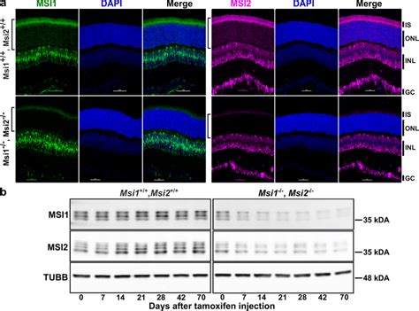Induced Double Knockout Of Msi1 And Msi2 In Photoreceptor Cells A