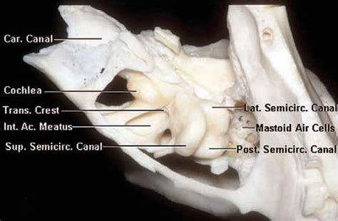 Internal Auditory Meatus
