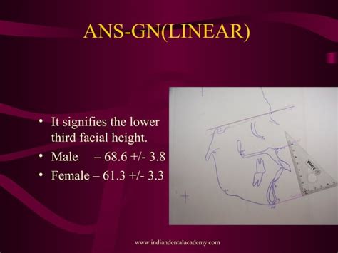 Cogs Analysis Cephelometrics For Orthognathic Surgery Fixed Cogs Analysis Cephelometrics For Orthognathic Surgery Fixed