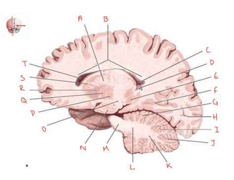 Sagittal Brain Slice 4 Flashcards Quizlet