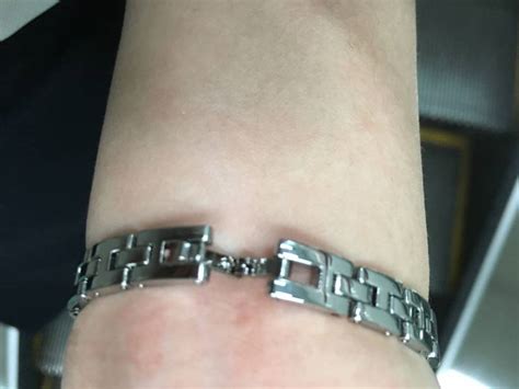 시계가 이상황에서 안빠지는데 어떡해 너무 아파 ㅜㅜㅜㅜ 인스티즈 Instiz 일상 카테고리