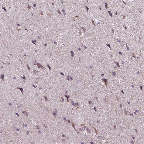Rabbit Polyclonal Anti Mlc1 Antibody Buy For Research Highly