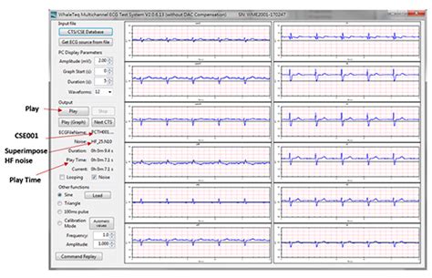 How To Use Ecg Testers To Verify Basic Performance Of Ecg Systems Whaleteq Ap Notes