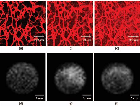 Figure 1 From Characterization Of Tumor Microvascular Structure And Permeability Comparison