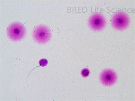 Scd Method Sperm Dna Fragmentation Test Kit Excellent Staining Ready To