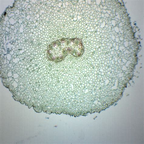 Ranunculus Young And Mature Root Cross Section Prepared Microscope