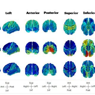 Sex Differences Across Cortical Measures Sex Effects Differences From Download Scientific