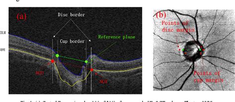 Figure 1 From Automated Segmentation Of Optic Disc In Sd Oct Images And