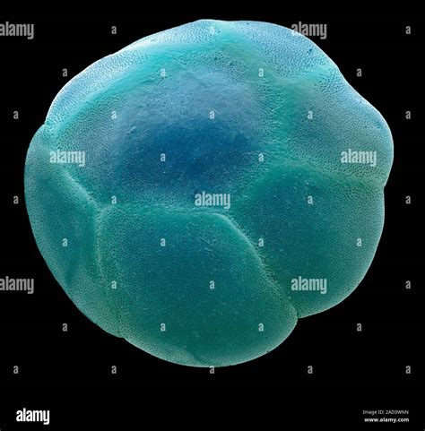 Foraminiferan Coloured Scanning Electron Micrograph Sem Of A Foraminiferan Microfossil From