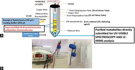 Detection Of Urinary Metabolites Of Metabolic Pathway Disord Journal Of Dental Research And