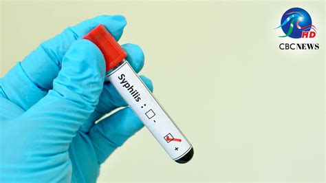 Syphilis Cases Increase In The Caribbean Caribbean Broadcasting