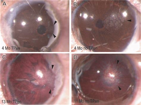 Photographs Of Dba 2 Cornea And Iris Showing Corneal Calcification Download Scientific Diagram
