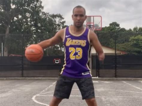 Amputation Levels Shamrock Prosthetics