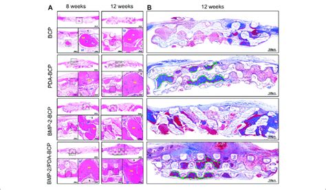 Histological Evaluation Of New Bone Formation In The Critical Size