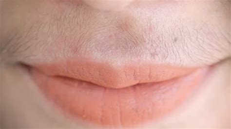 Hirsutism In Women Follow These Tips To Balance Your Hormones