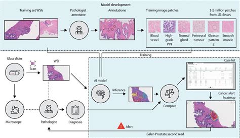 An Artificial Intelligence Algorithm For Prostate Cancer Diagnosis In