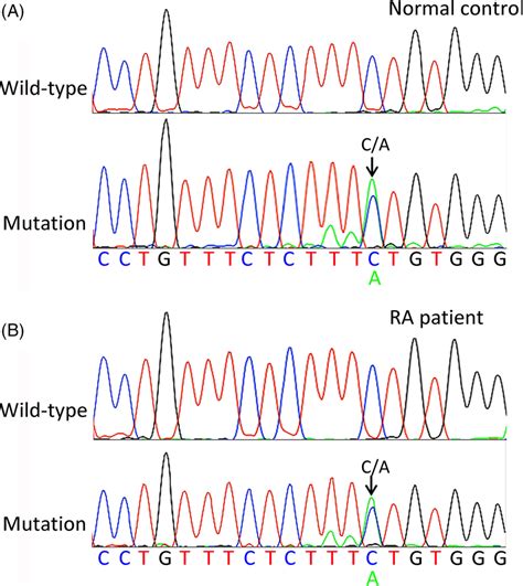 Direct Sequence Analysis Of Rs558555834 Showed Heterogeneous C To A