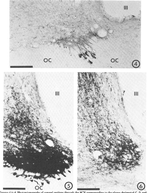 Structure Of Suprachiasmatic Nucleus Semantic Scholar
