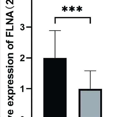 The Quantitative Analysis Results Of Flna Gene Expression In