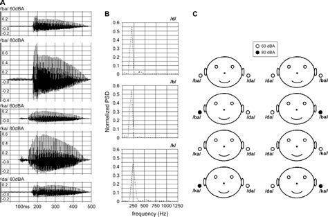 Figure 1 From Lateralization Of Dichotic Speech Stimuli Is Based On Specific Auditory Pathway