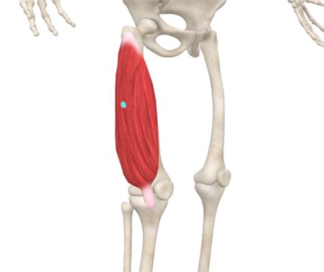 Trigger Point Of The Week Vastus Lateralis
