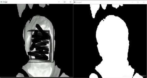 各项异性扩散（anisotropic Diffusion） 算法简介（python）代码实现 各向异性扩散python图像处理 Csdn博客