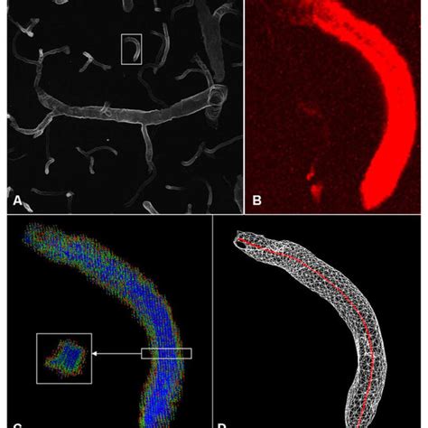 Illustrating The Voting Based Centerline Extraction Method A Download Scientific Diagram