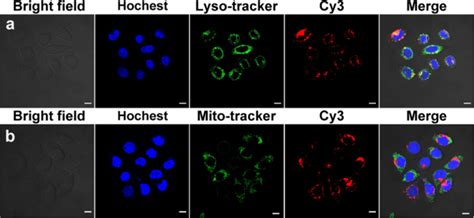 Upconversion Luminescence Activated Dna Nanodevice For Atp Sensing In