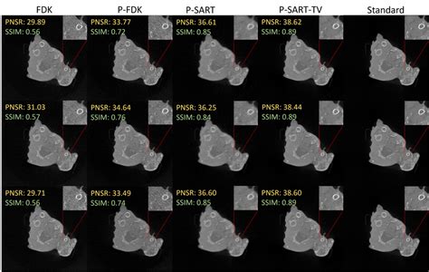 Simulation Results With Poisson Noise The Reconstruction Results Of Download Scientific