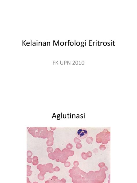 Kelainan Morfologi Eritrosit
