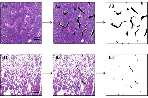 Trabecular Bone Microarchitecture Evaluation In An Osteoporosis Mouse Model
