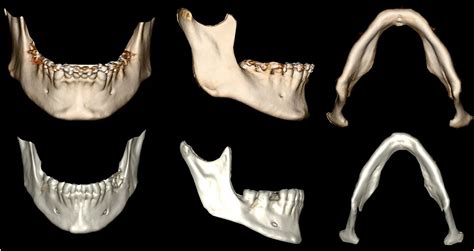 Gender Affirming Facial Surgery Oral And Maxillofacial Surgery Clinics