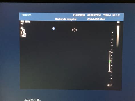 Philips C10 3v Broadband Curved Array Transducer Probe Auschoice