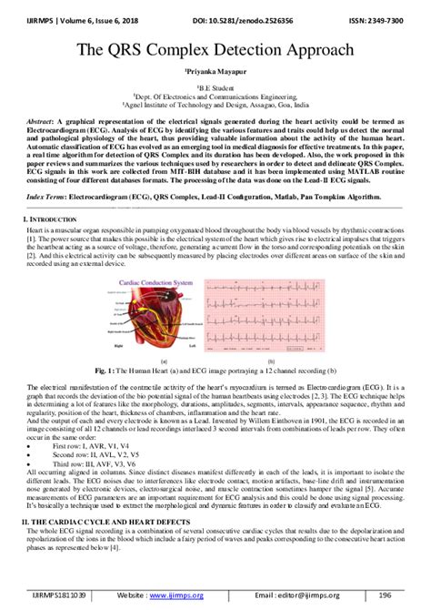 Pdf The Qrs Complex Detection Approach