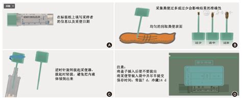 定量免疫法粪便隐血试验筛查结直肠癌的技术规范指导建议 乳胶 中心 筛查