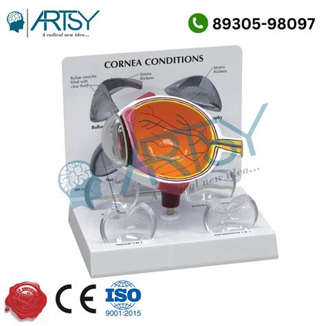 Pvc Cornea Eye Cross Section Model For School At ₹ 3599 In Ambala Id