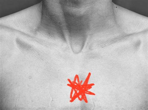 Xiphoid Process Protrusion