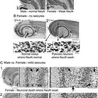 Sex Differences In The Entorhinal Cortex A A Horizontal Section Of Download Scientific