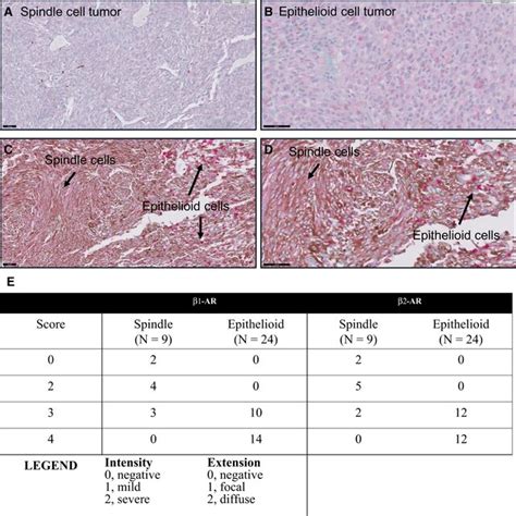 Expression Of β‐adrenoceptor Ar Types 1 And 2 Immunohistochemical Download Scientific