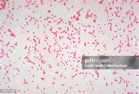 Acinetobacter Baumannii Gram Stain