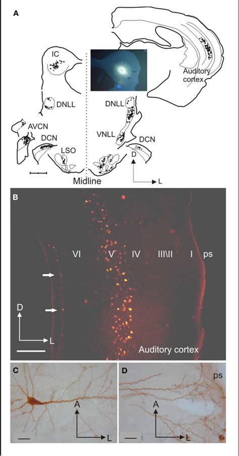 Figure 1 From Cortical Modulation Of Auditory Processing In The Midbrain Semantic Scholar