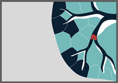 Improving Diagnosis For Incidental Pulmonary Embolism Ipe In The Clinical Workflow The Role
